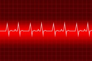 Cardiac Arrhythmia Interpretation Courses – Cardiovascular Nursing ...
