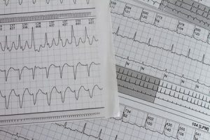 Cardiac Arrhythmia Interpretation Courses – Cardiovascular Nursing ...
